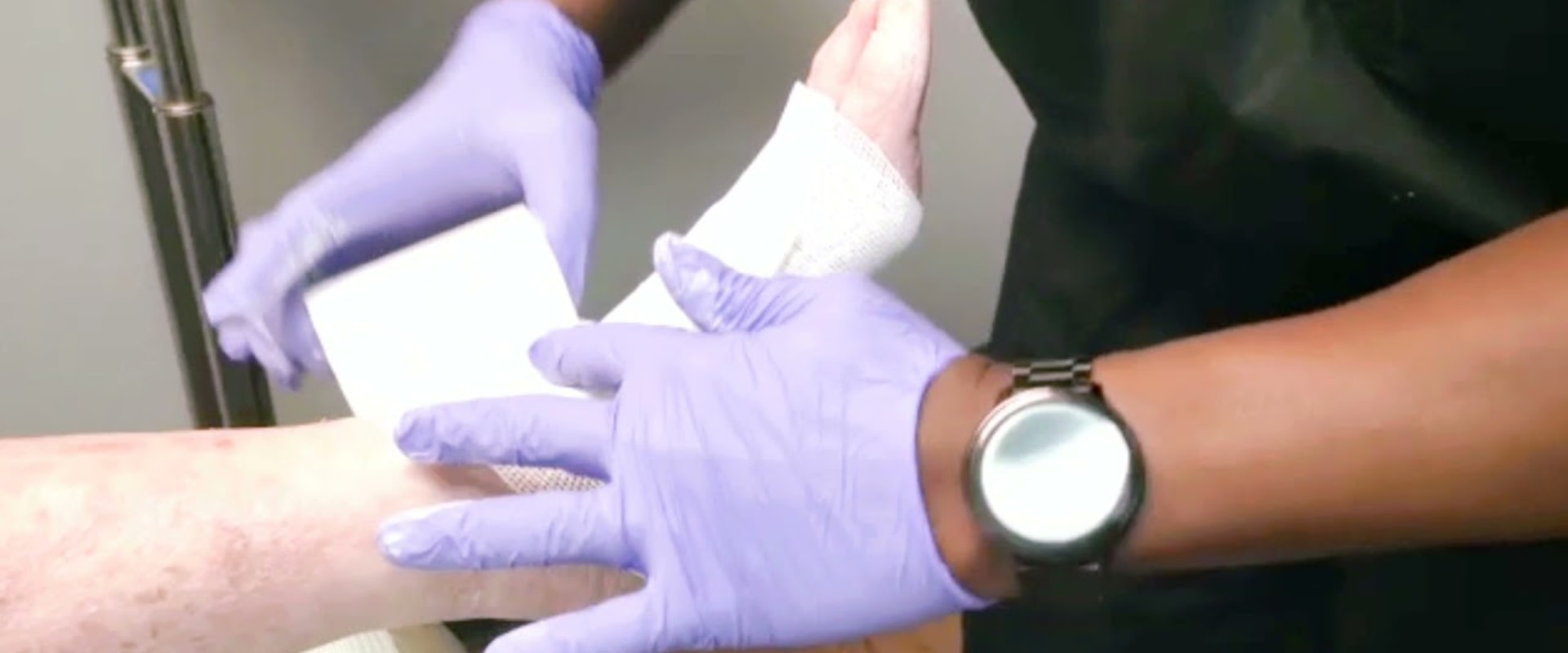 Unna Boot Application: Discover How to Reduce Swelling and Boost Healing