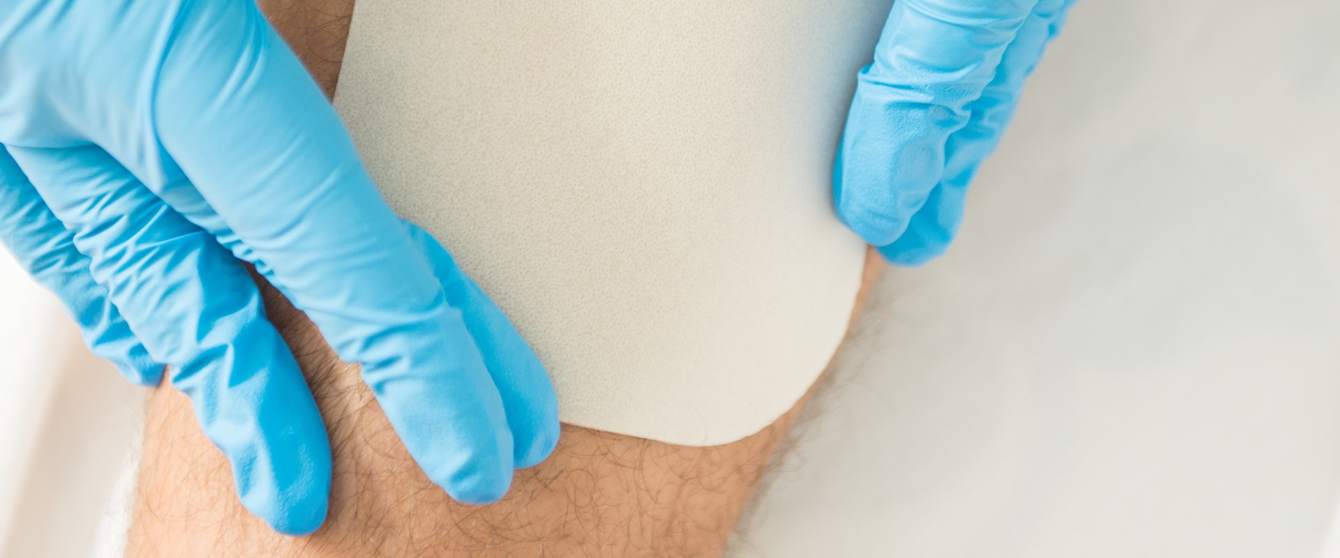 The Importance of Understanding Wound Care Management