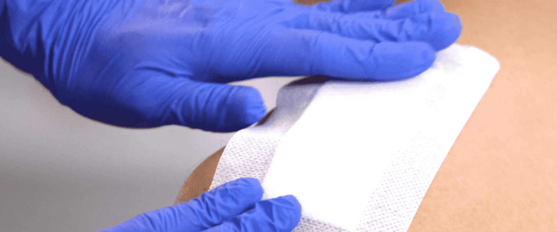 Hydrocolloid Dressing Examples for Precision and Care in Wound Assessment