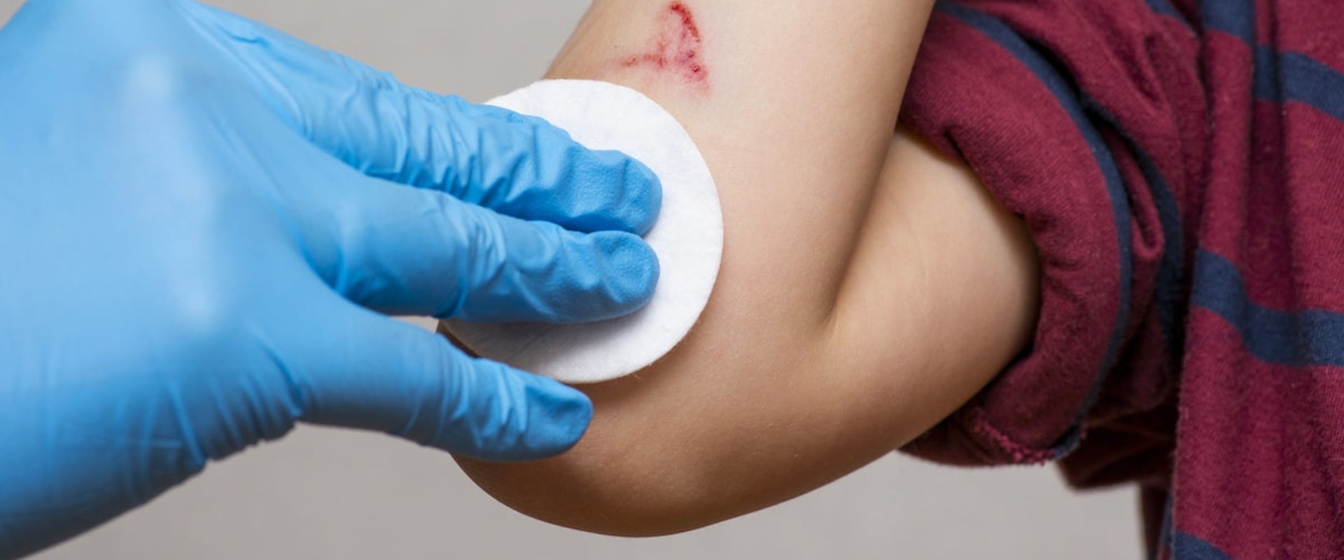 Think Your Wound Looks Off? Healthy vs Infected Wound Guide